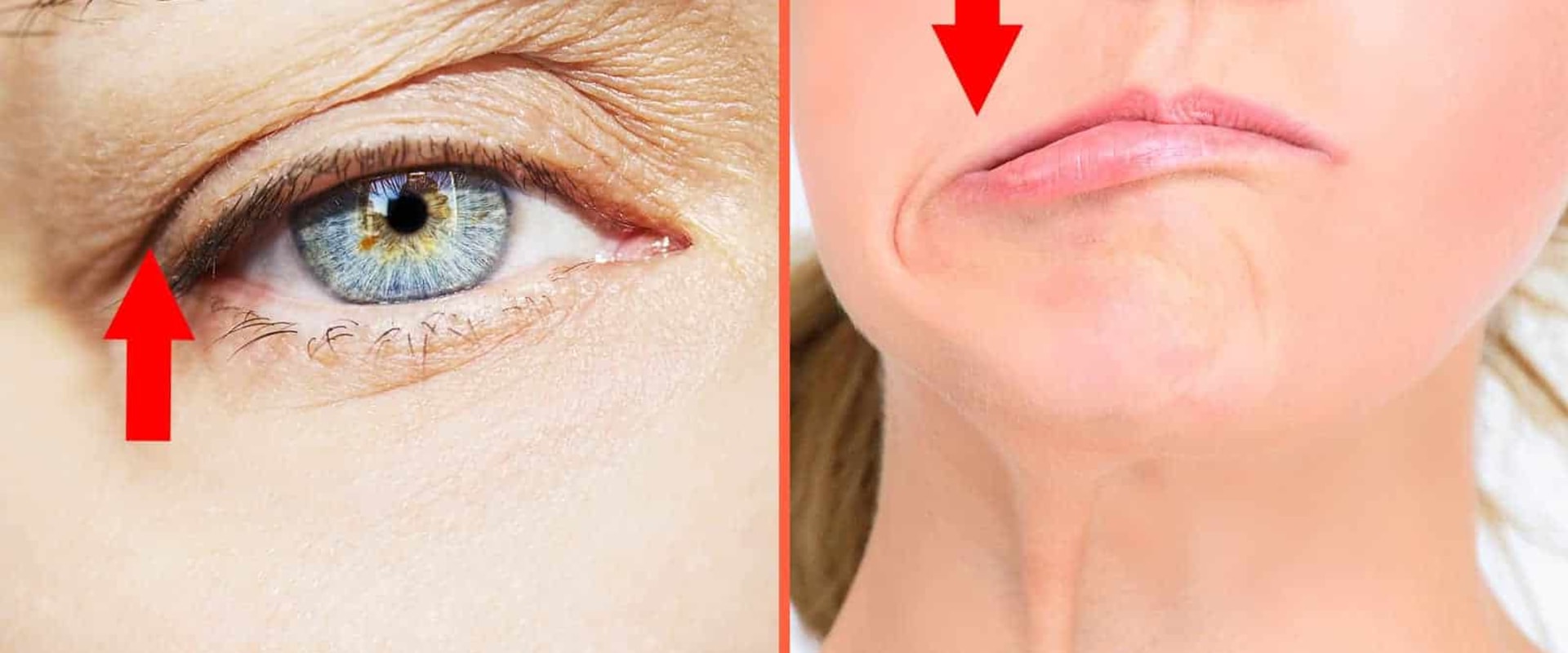 The Potential Negative Effects of Botox